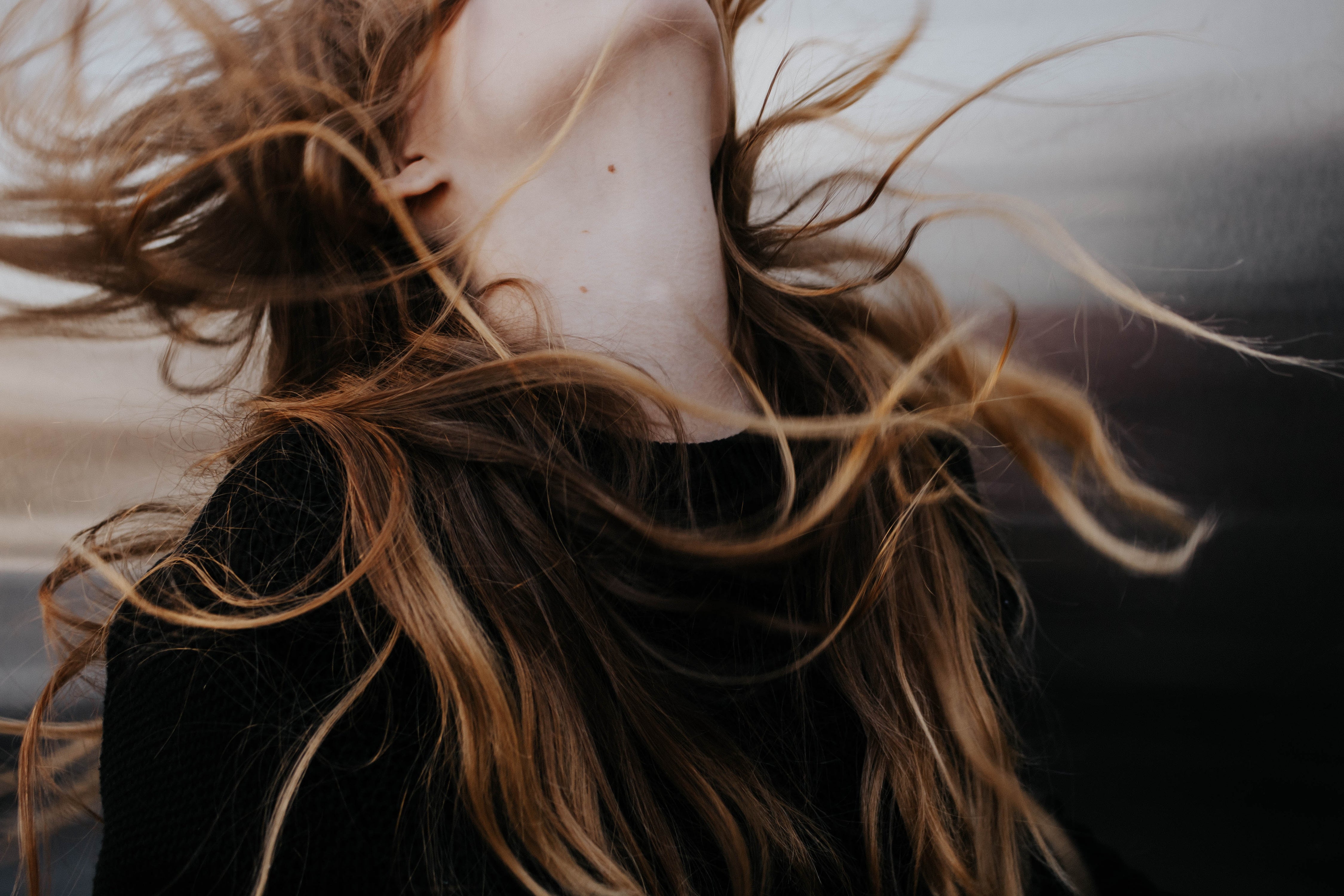How can you tell if you’re going bald? 7 things to watch out for - VALI ...